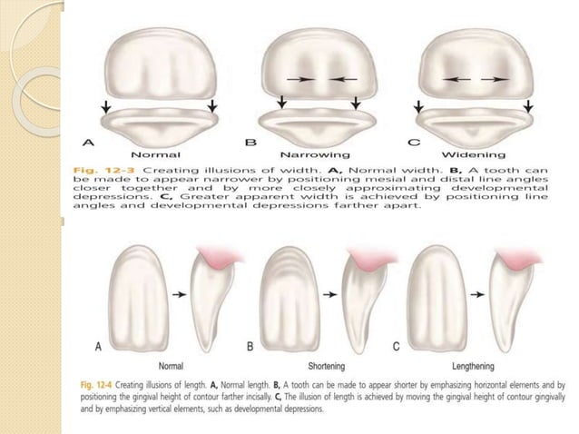Introduction to esthetic dentistry | PPTX