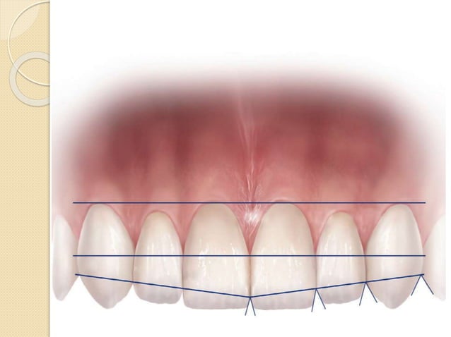 Introduction to esthetic dentistry | PPTX