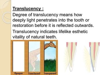 Introduction to esthetic dentistry | PPTX