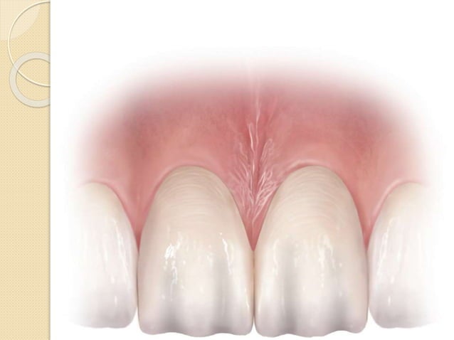 Introduction to esthetic dentistry | PPTX