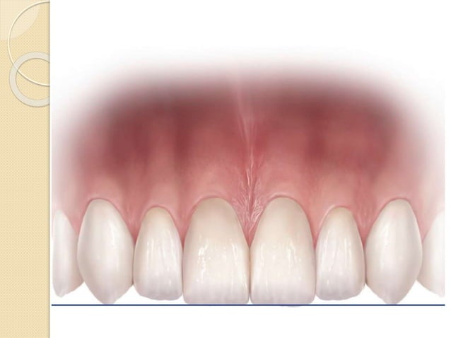 Introduction to esthetic dentistry | PPTX