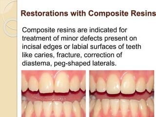 Introduction to esthetic dentistry | PPTX
