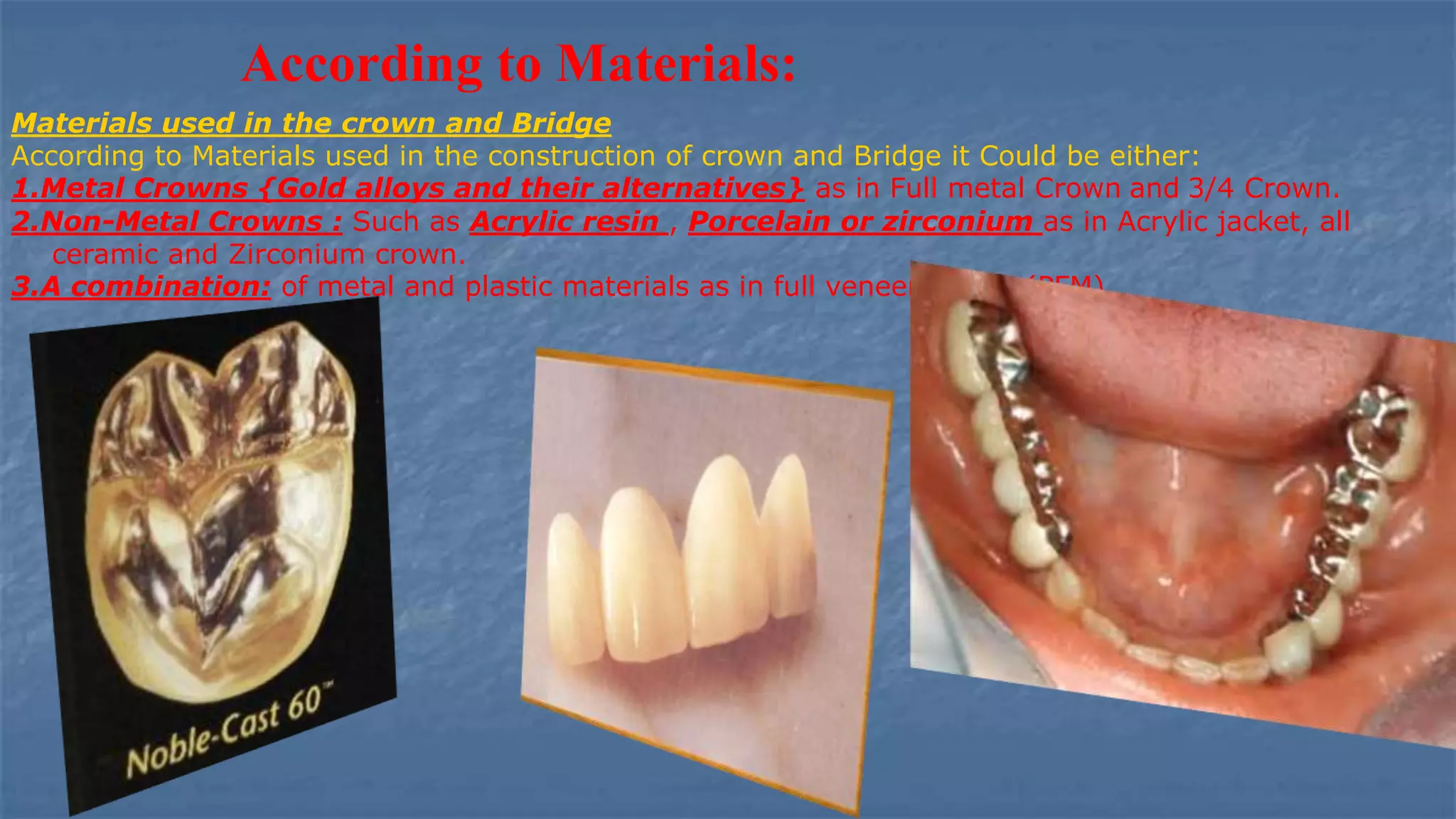 Introduction to fixed prosthodontics | PPTX