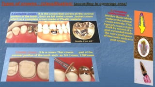 Introduction to fixed prosthodontics | PPTX