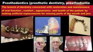 Introduction to fixed prosthodontics | PPTX
