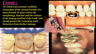 Introduction to fixed prosthodontics | PPTX