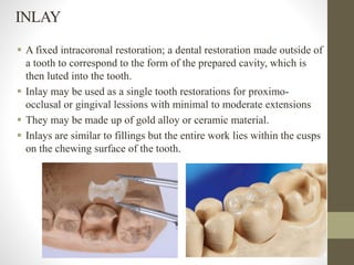 INTRODUCTION TO FIXED PROSTHODONTICS.pptx