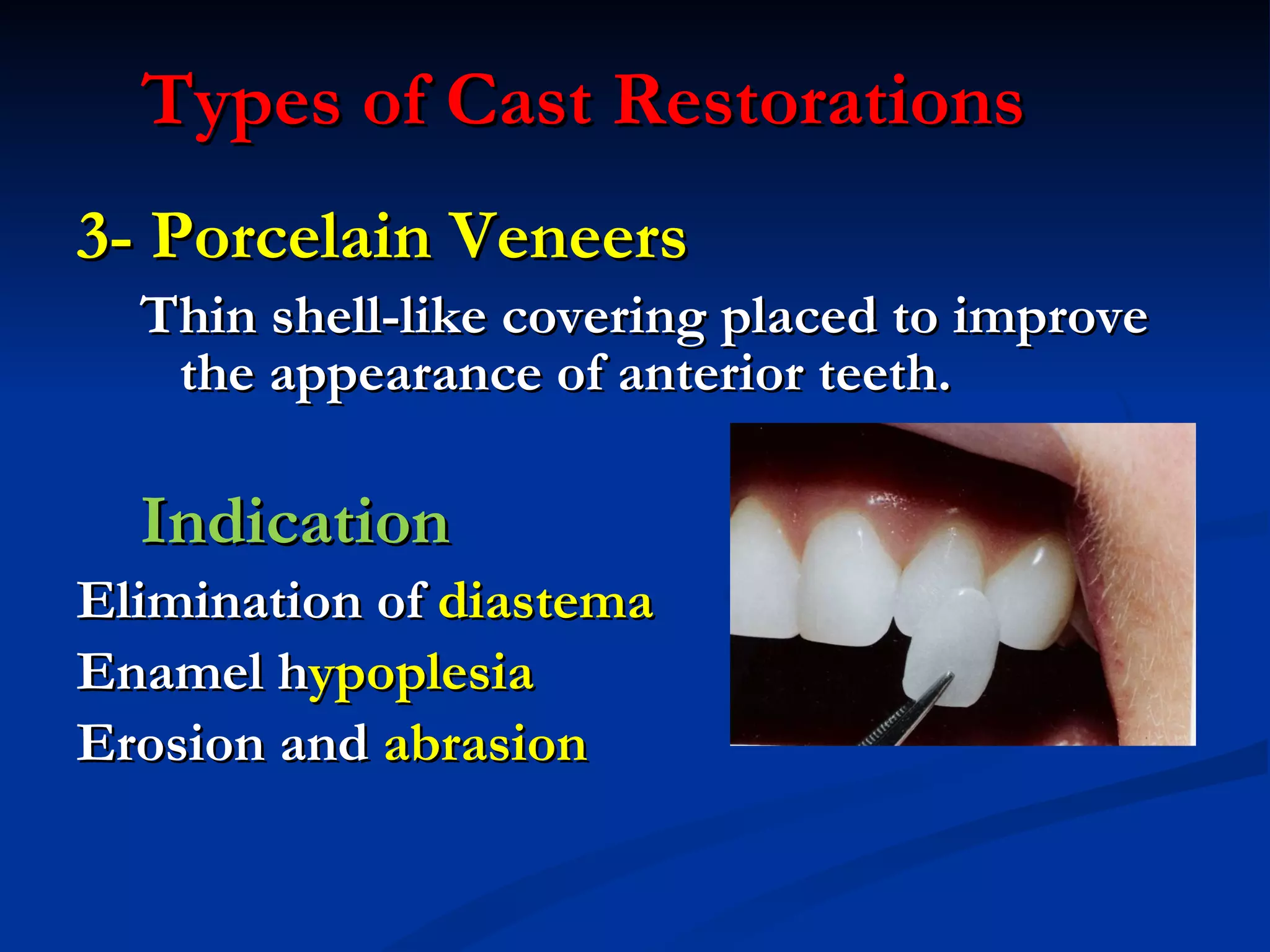 Introduction to fixed prosthodontics | PPT