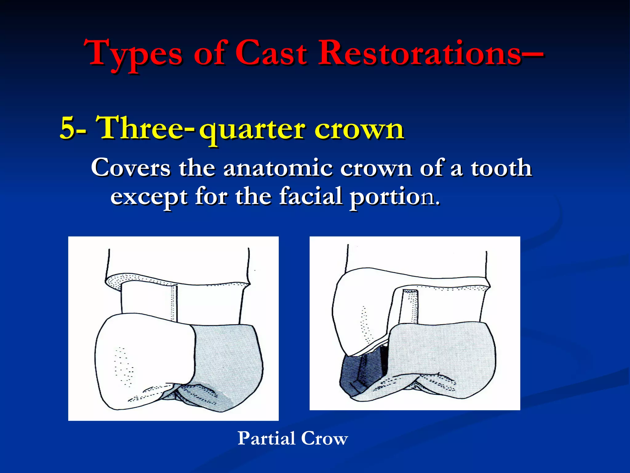 Introduction to fixed prosthodontics | PPT