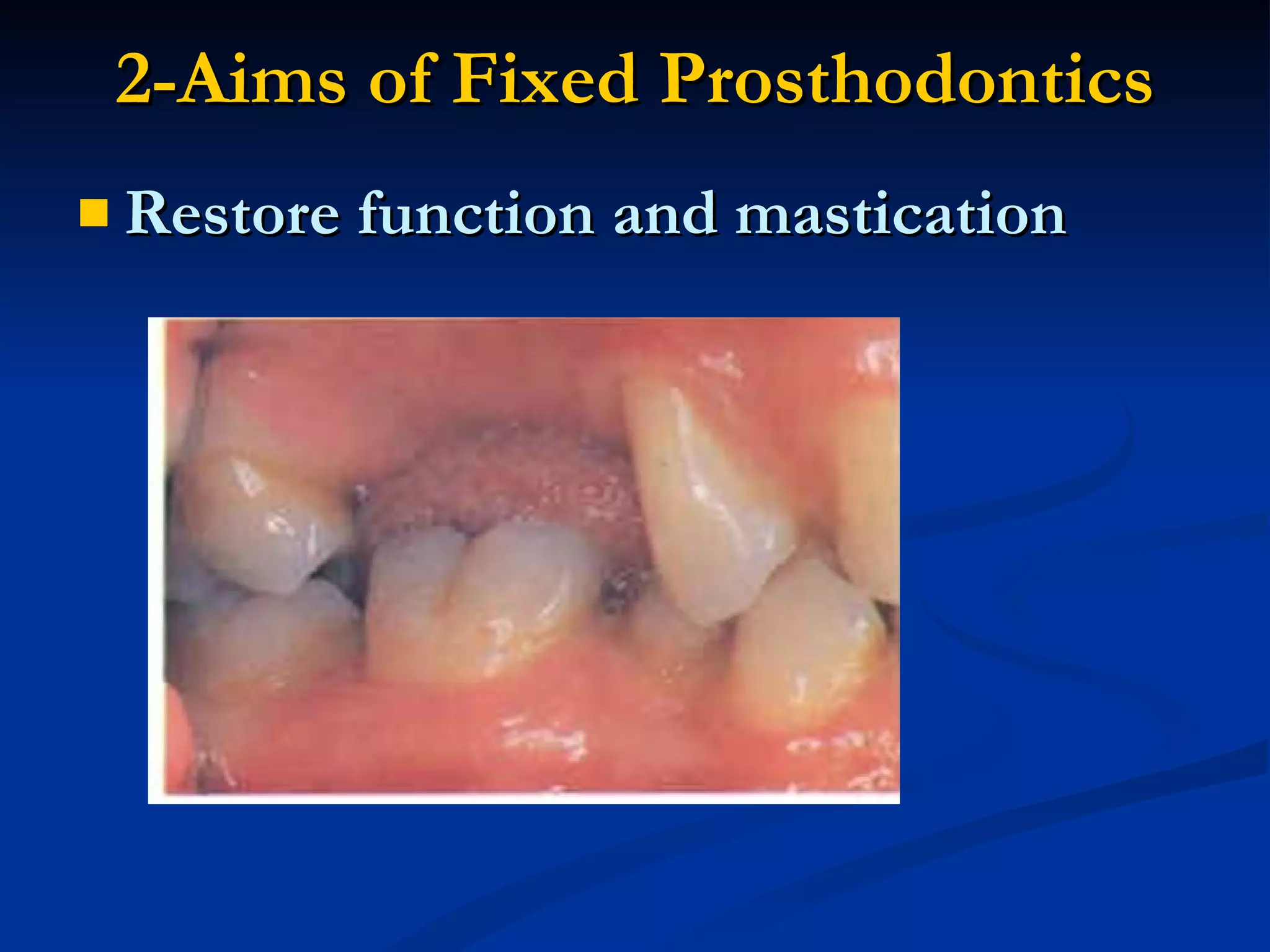 Introduction to fixed prosthodontics | PPT