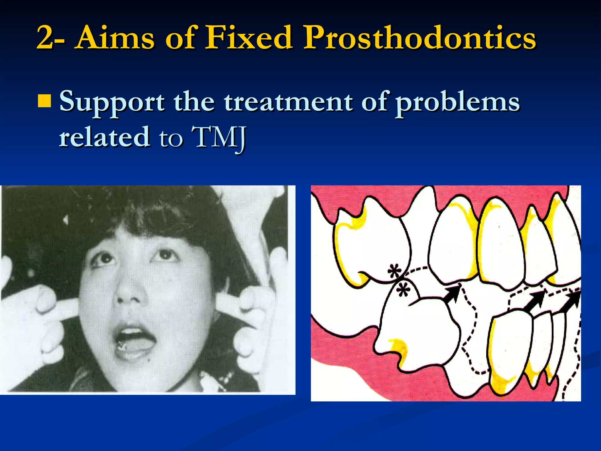 Introduction to fixed prosthodontics | PPT