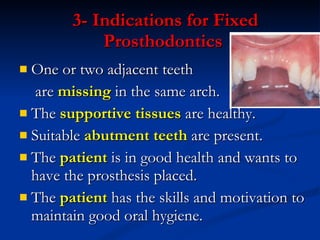 Introduction to fixed prosthodontics | PPT