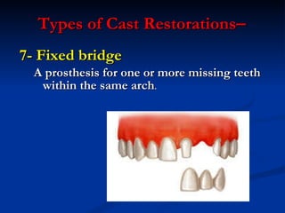 Introduction to fixed prosthodontics | PPT