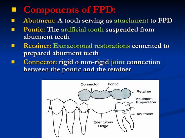 Introduction to fixed prosthodontics | PPT