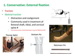 Introduction to fractures management.pdf