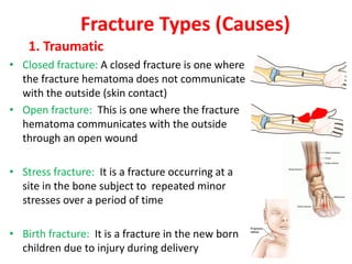 Introduction to fractures management.pdf