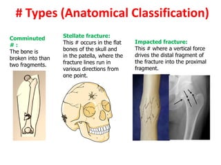 Introduction to fractures management.pdf