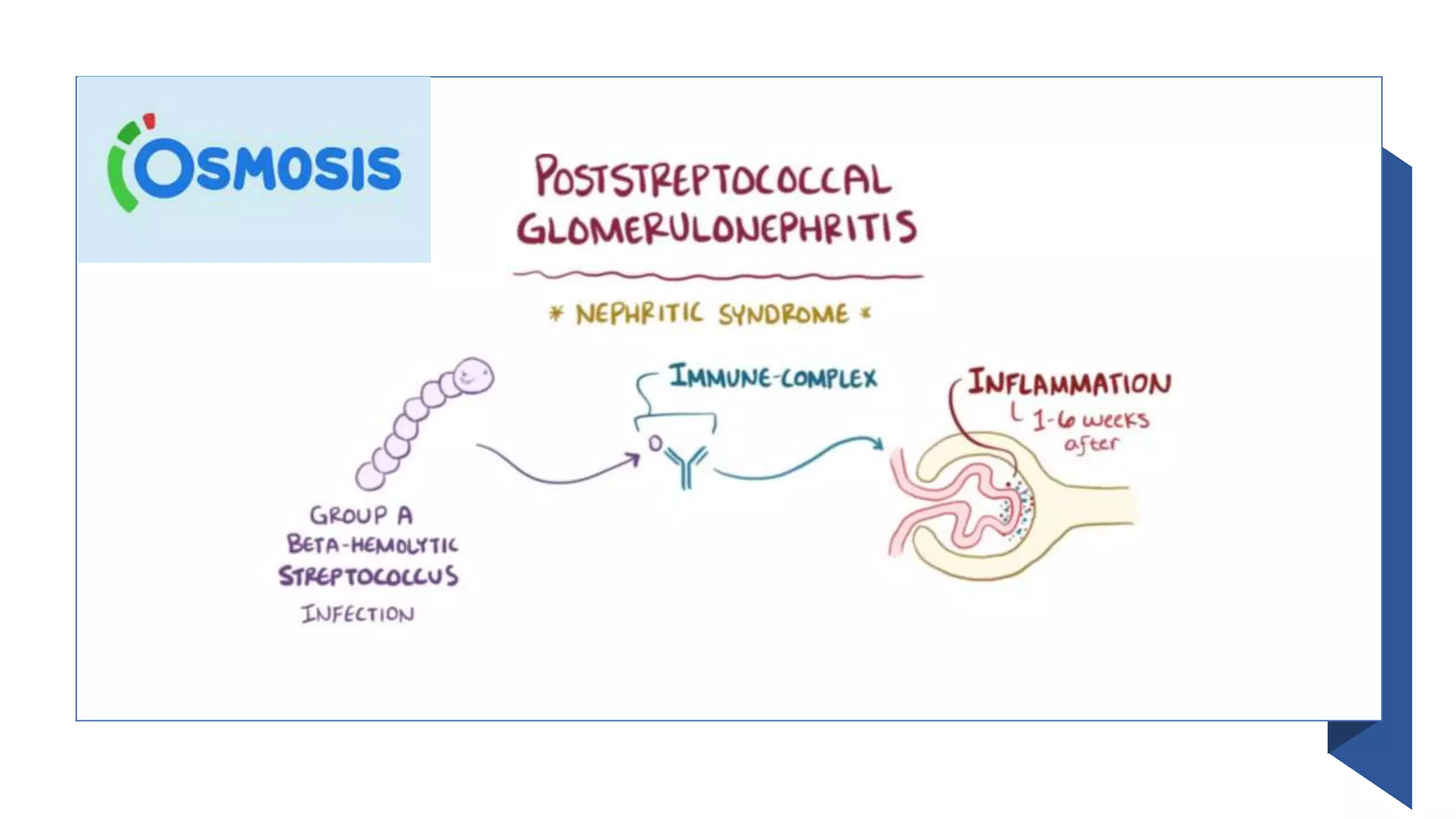 Introduction to GN glomerulonephritis, case-based approach Ahmed Yehia ...