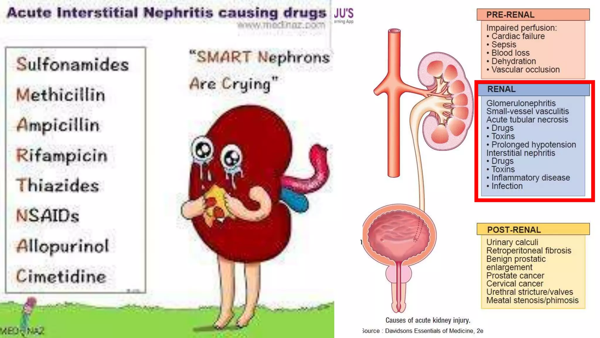Introduction to GN glomerulonephritis, case-based approach Ahmed Yehia ...
