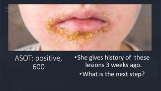 Introduction to GN glomerulonephritis, case-based approach Ahmed Yehia ...