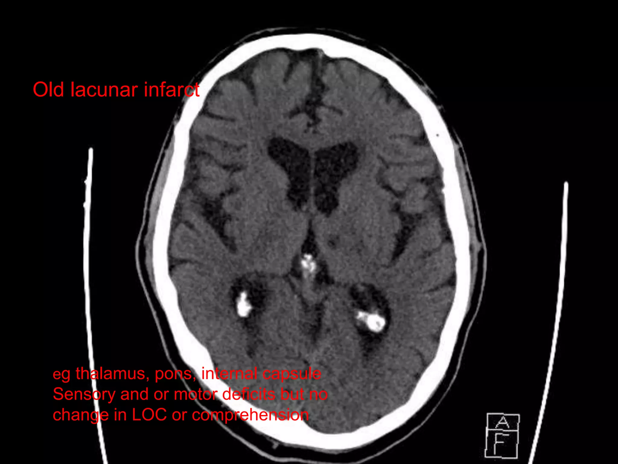 Introduction to head ct | PPTX