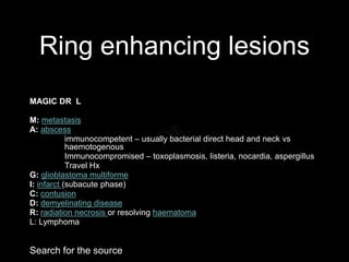 Introduction to head ct | PPTX