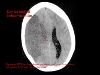 Introduction to head ct | PPTX