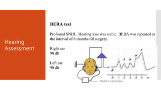 Introduction to hearing implairment & cochlear implantation] | PPT