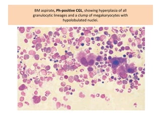 Introduction to hematology lab | PPT