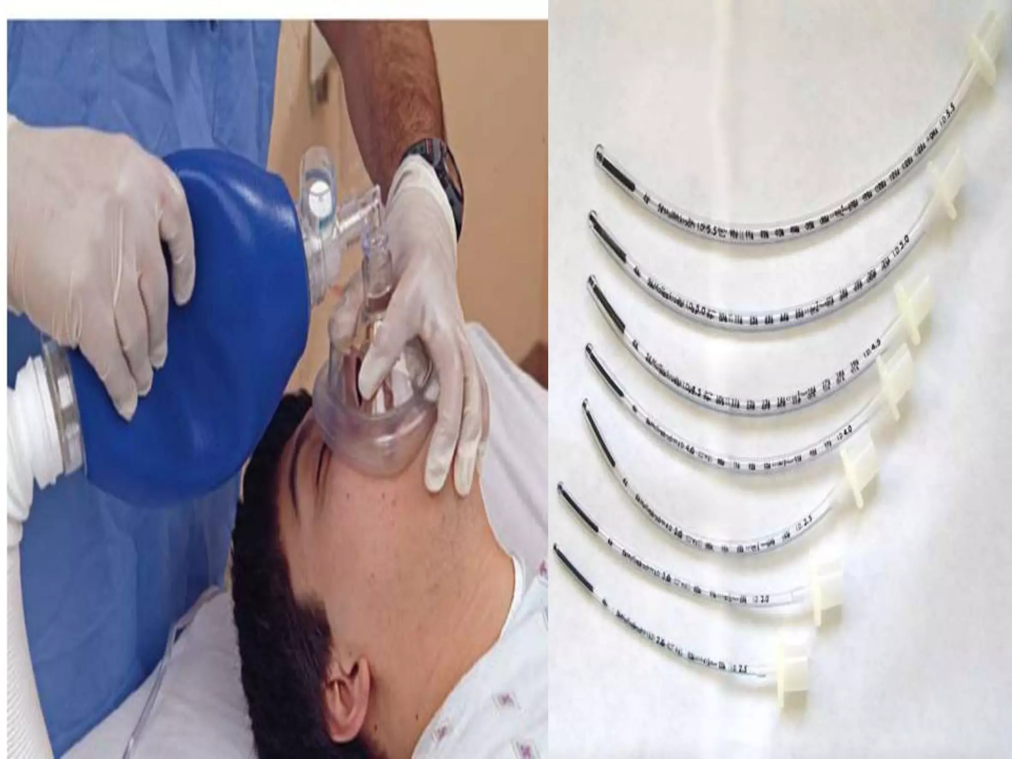 Introduction to ICU Basics in ICU | PPTX