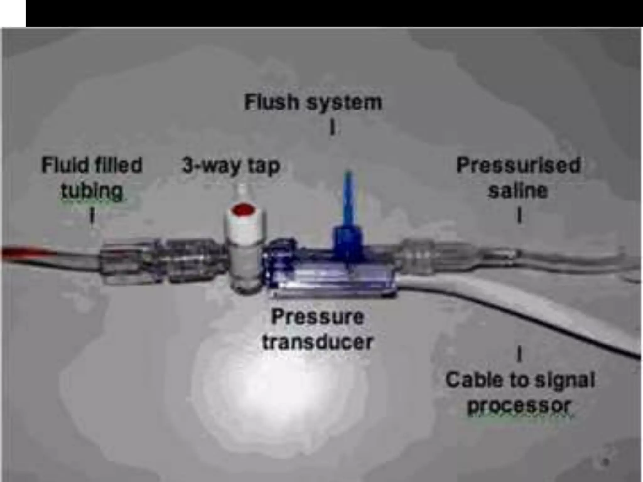 Introduction to ICU Basics in ICU | PPTX