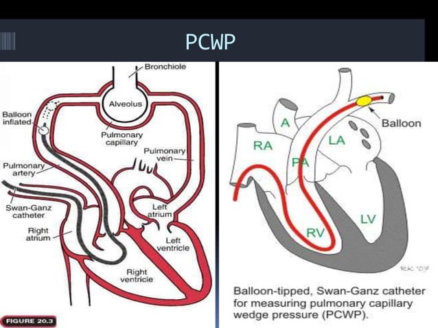 Introduction to ICU Basics in ICU | PPTX
