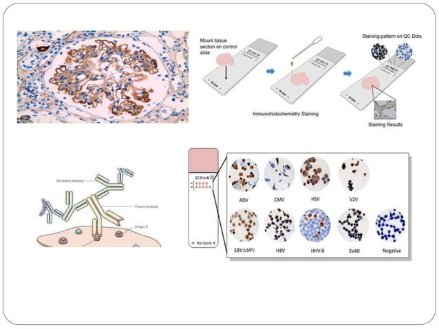 Introduction to IHC | PPT