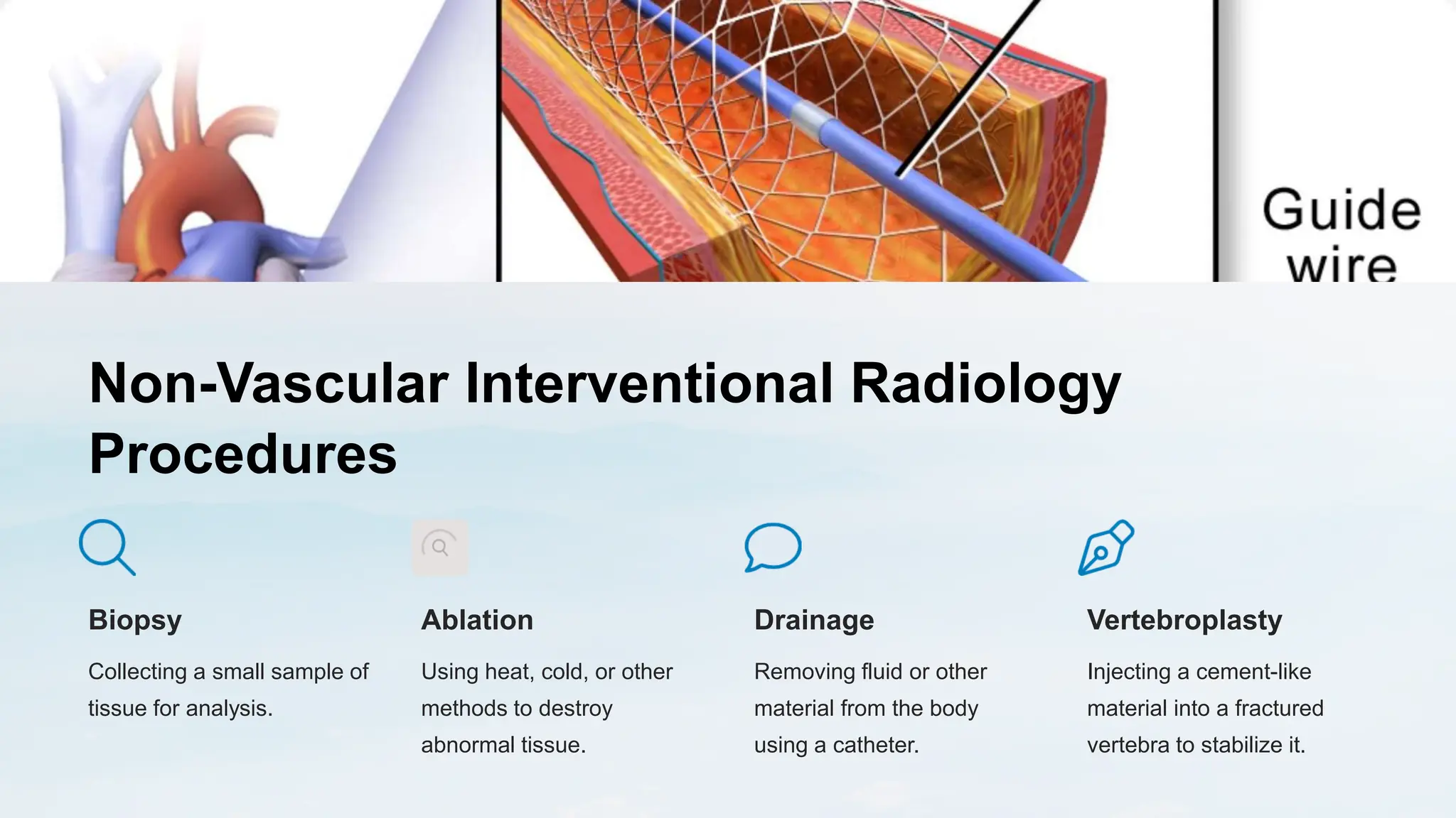 Introduction to Interventional Radiology.pptx