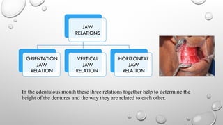 Introduction to jaw relation in complete denture.pptx
