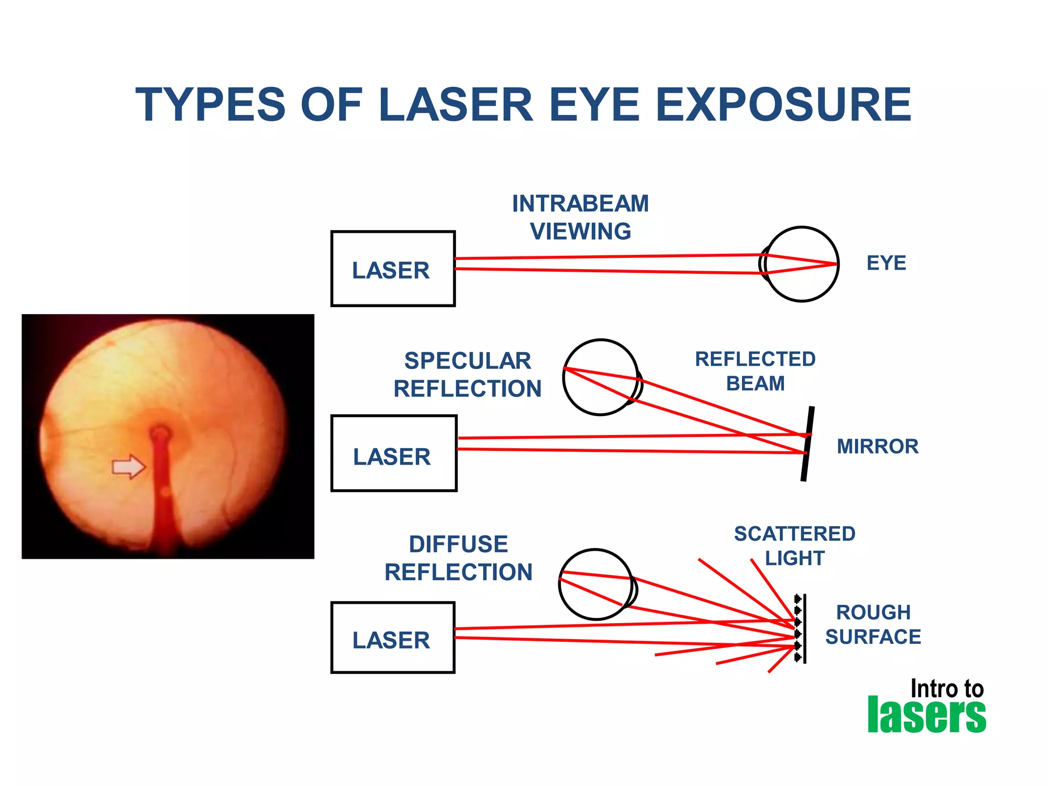 Introduction to Lasers | PDF