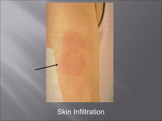 Introduction to leukemia | PPT