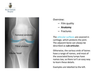 RAH Med 4 Ortho - Limb Imaging 1 | PPTX