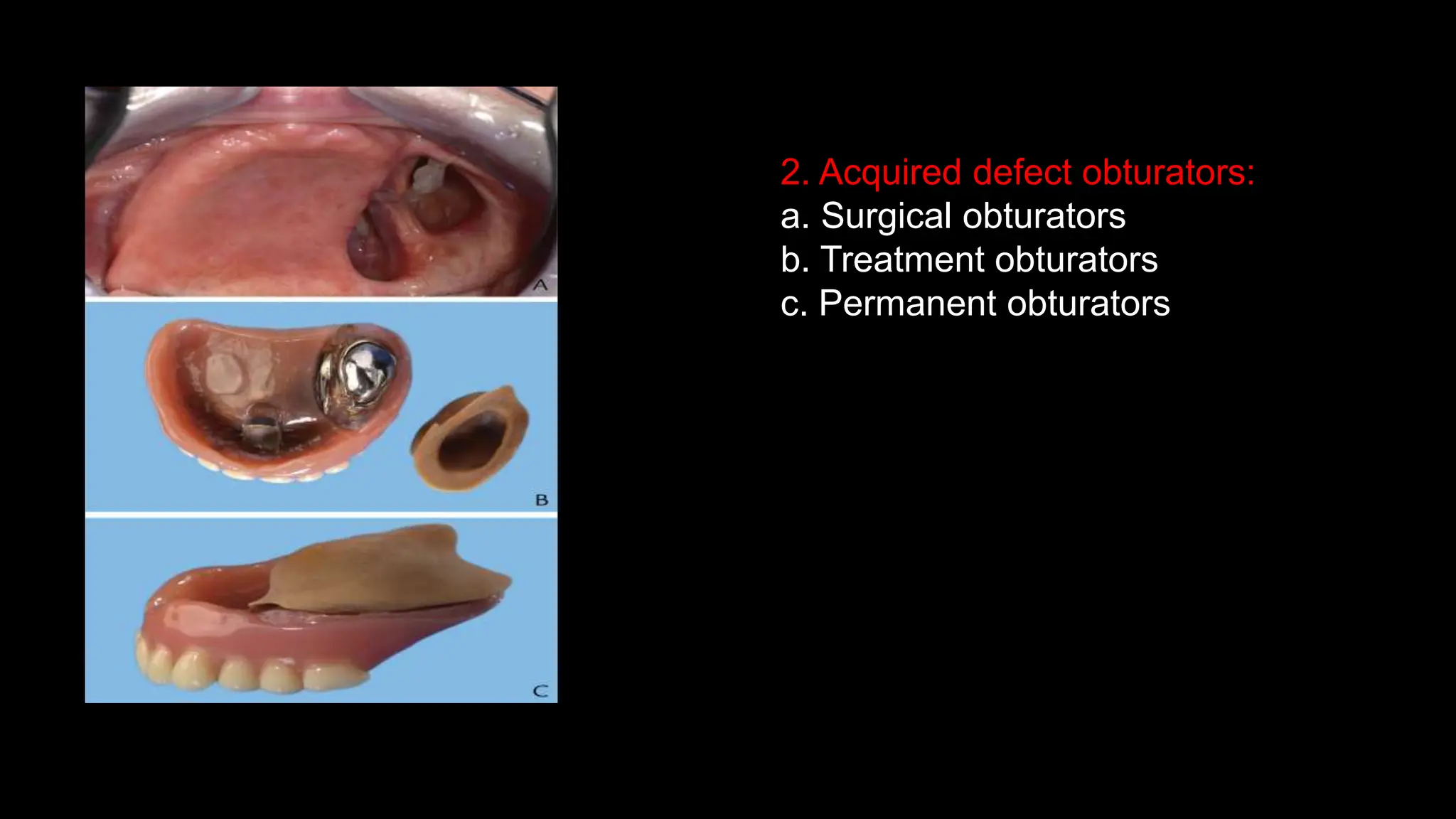 Introduction to Maxillofacial Prosthodontics.pptx