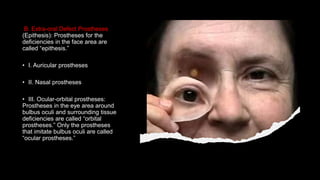 Introduction to Maxillofacial Prosthodontics.pptx