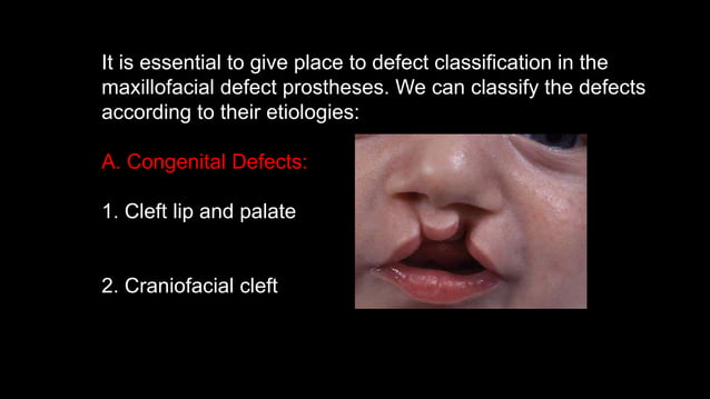 Introduction to Maxillofacial Prosthodontics.pptx | Dental Health ...