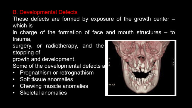 Introduction to Maxillofacial Prosthodontics.pptx | Dental Health ...