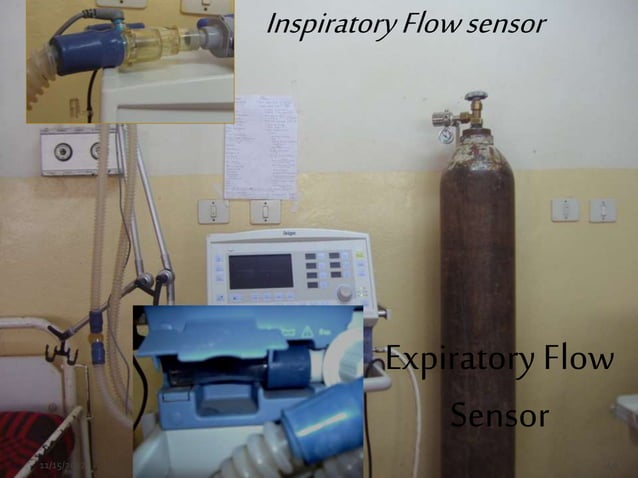 Introduction to mechanical ventilator | PPTX | Lung and Respiratory ...