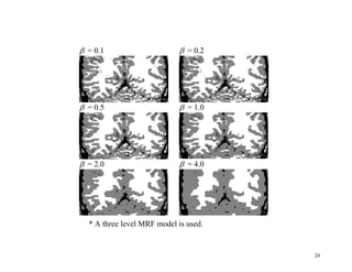 Introduction to medical image processing.pdf