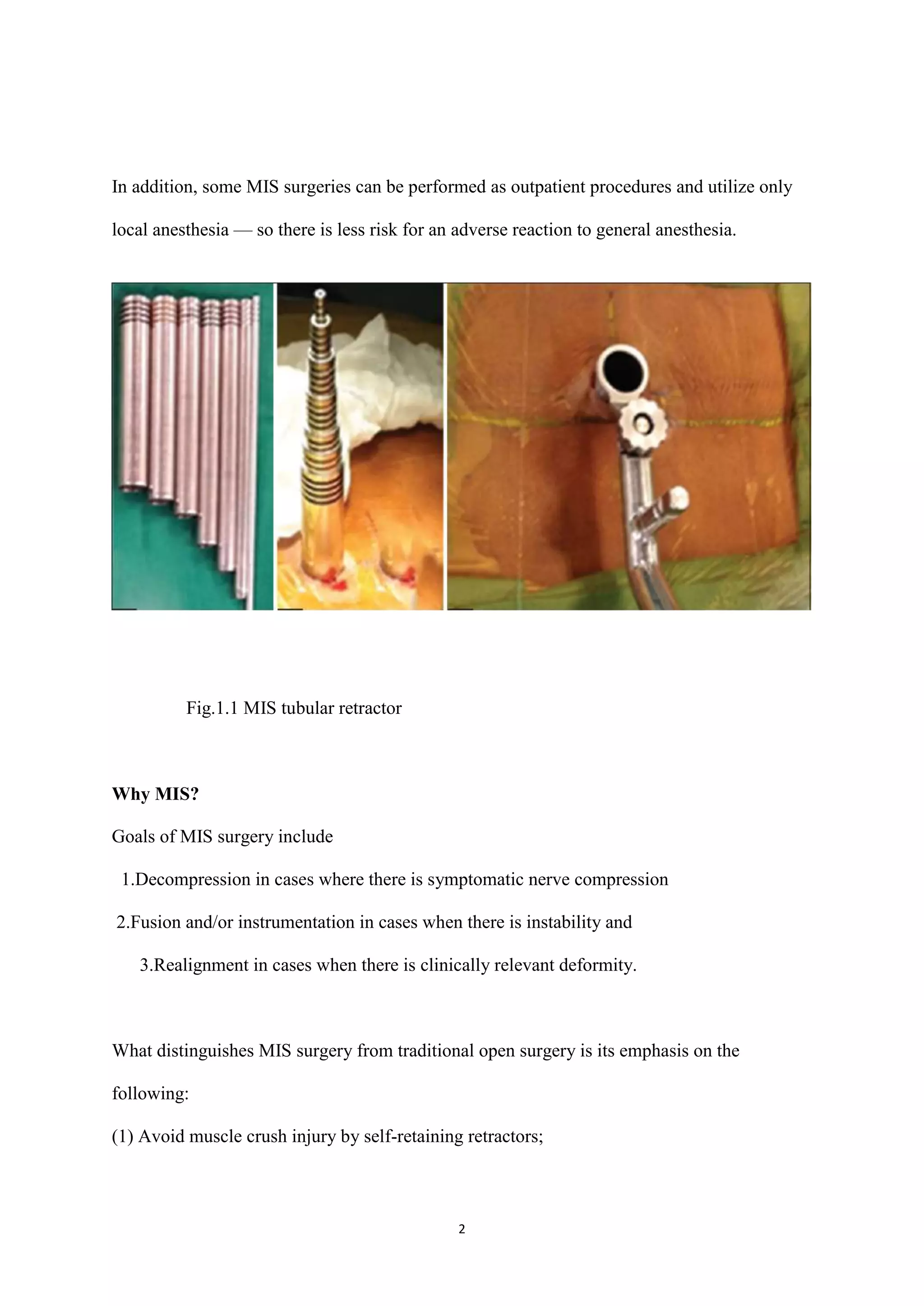 Introduction to Minimally Invasive Spine Surgery(1).docx