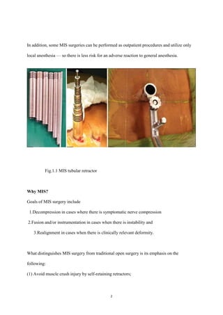 Introduction to Minimally Invasive Spine Surgery(1).docx