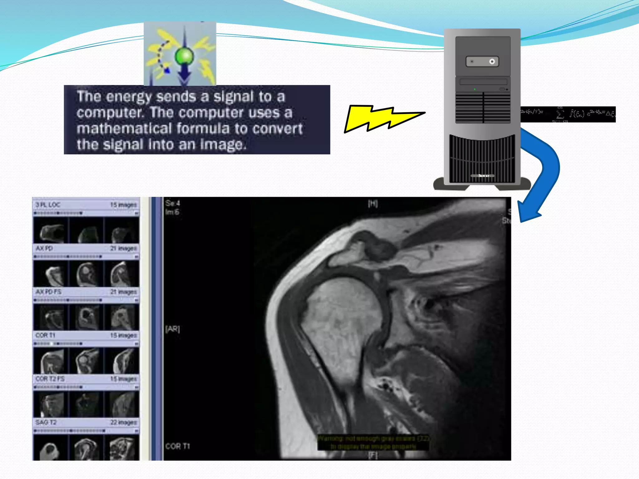 Introduction to mri | PPTX