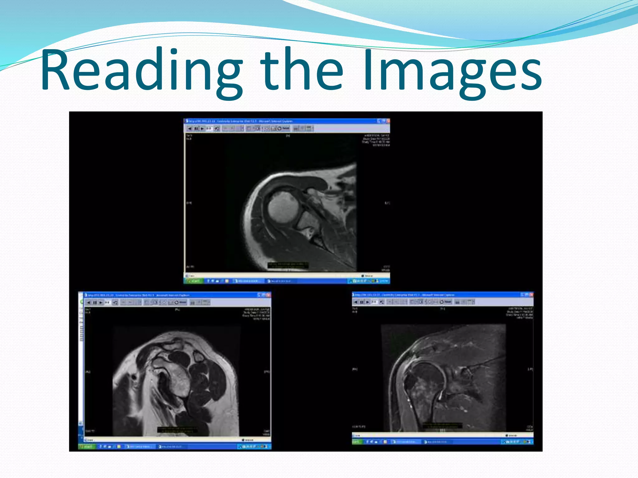 Introduction to mri | PPTX