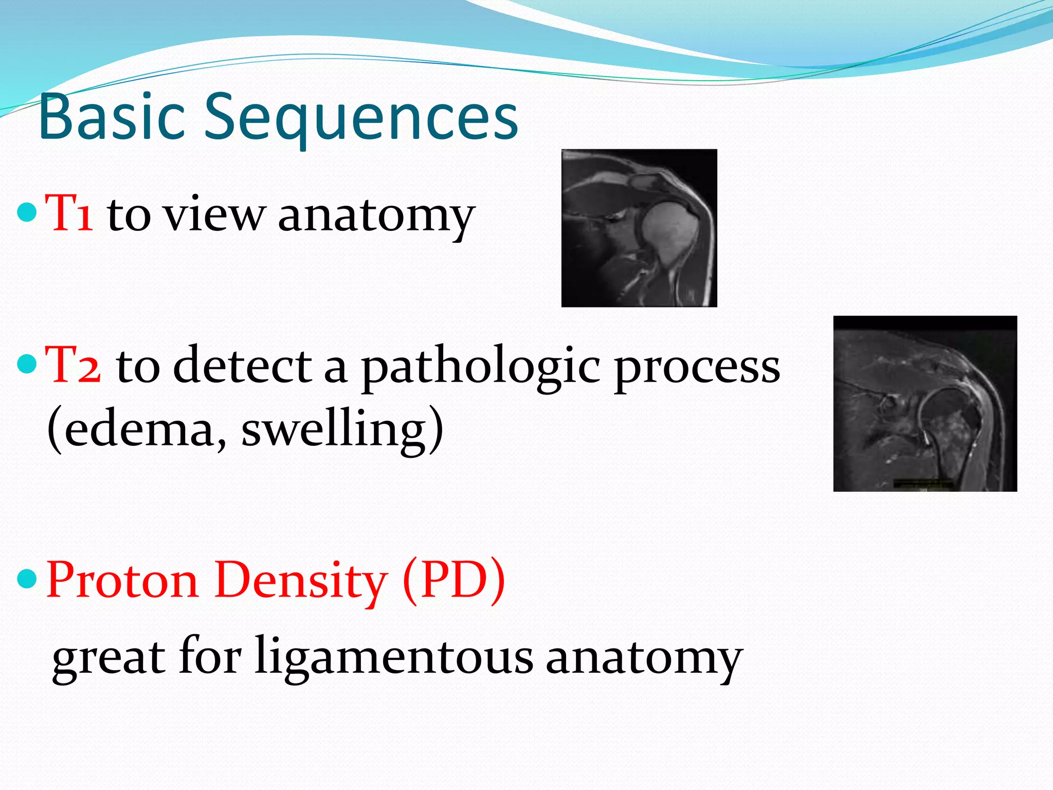 Introduction to mri | PPTX