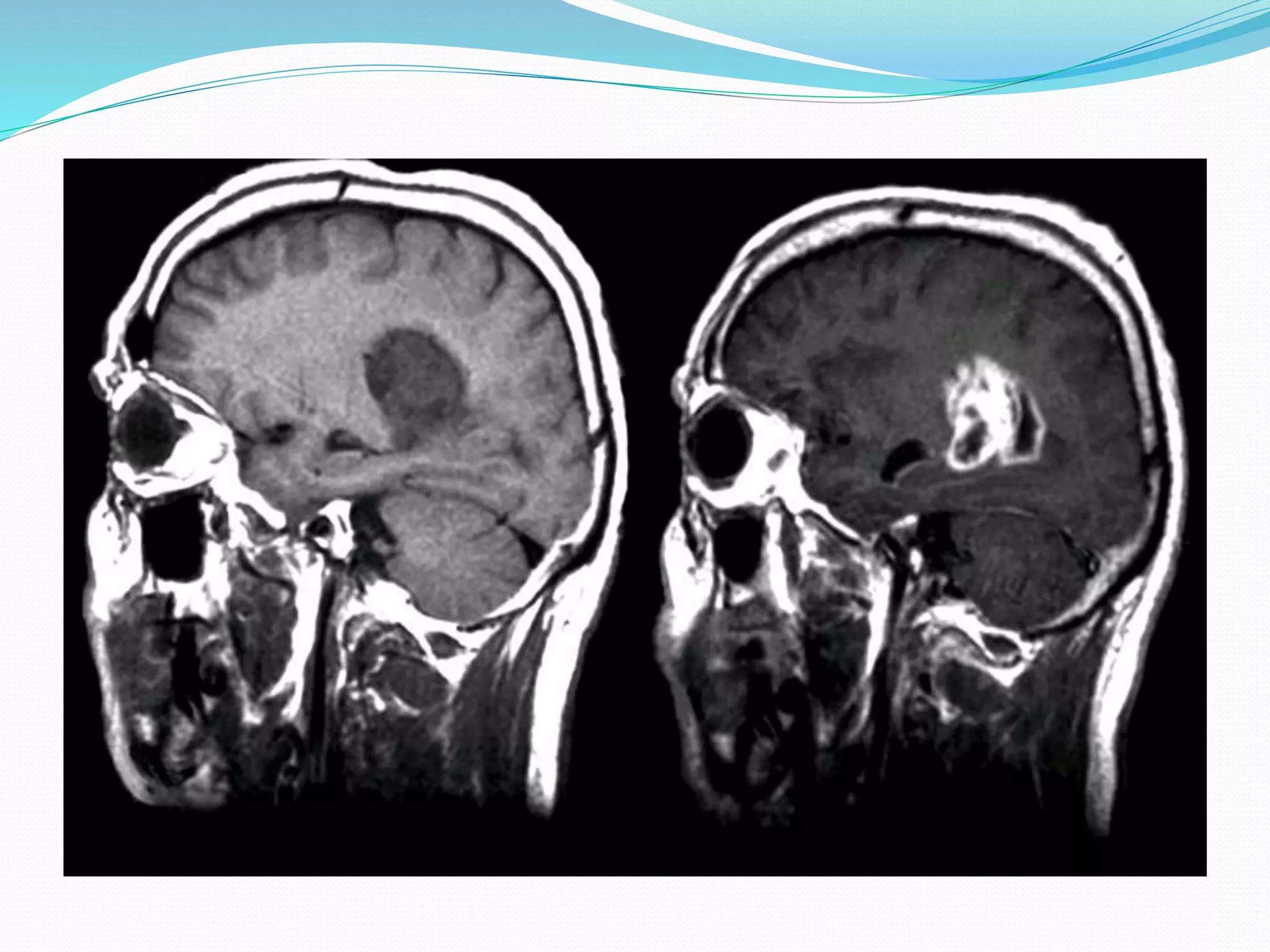 Introduction to mri | PPTX